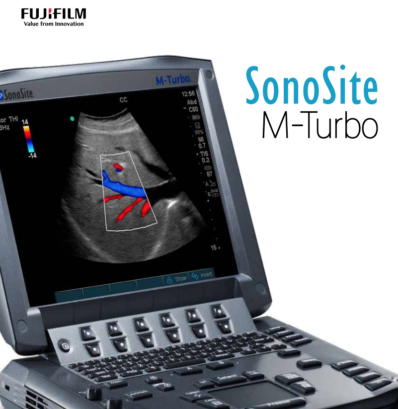 Sonosite Ultrasound - National Electro Tech